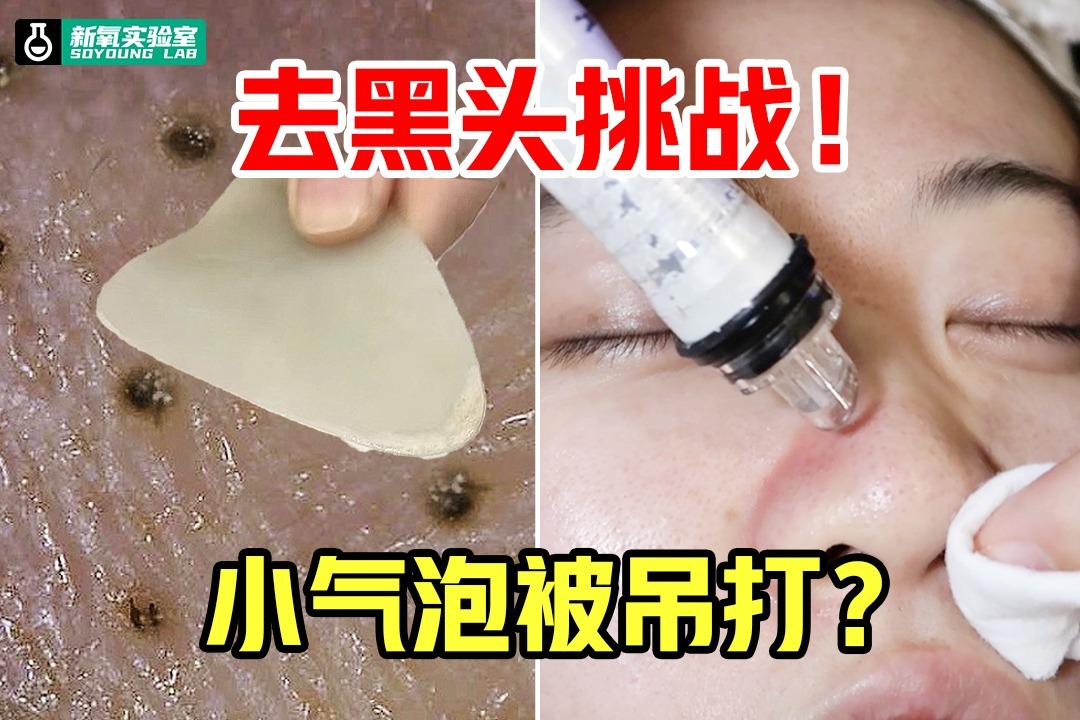 如何有效清理黑头？凤凰网视频凤凰网